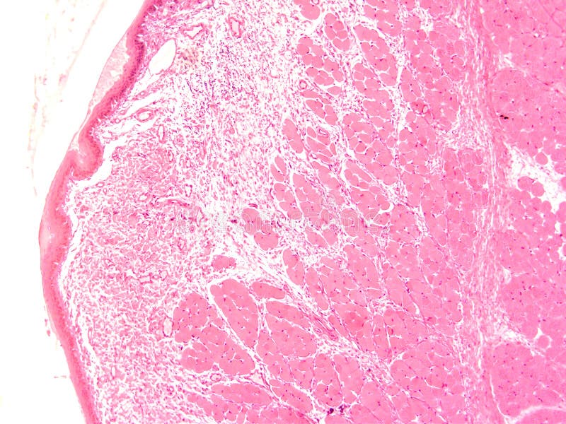 Histology of Human Larynx Tissue Stock Photo - Image of study, columnar ...
