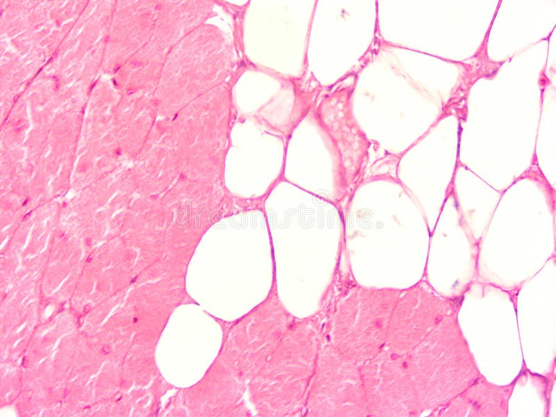 Histology of Human Larynx Tissue Stock Photo - Image of ovary ...