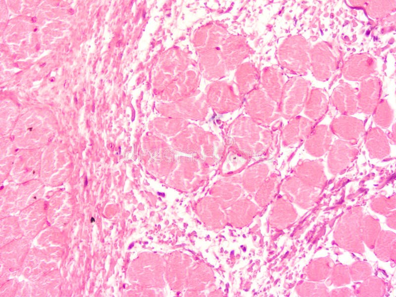 Histology of Human Larynx Tissue Stock Photo - Image of thyroid, study ...