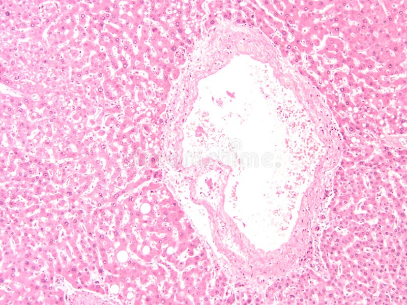 Histology of Human Liver Tissue Stock Image - Image of liver, histology ...