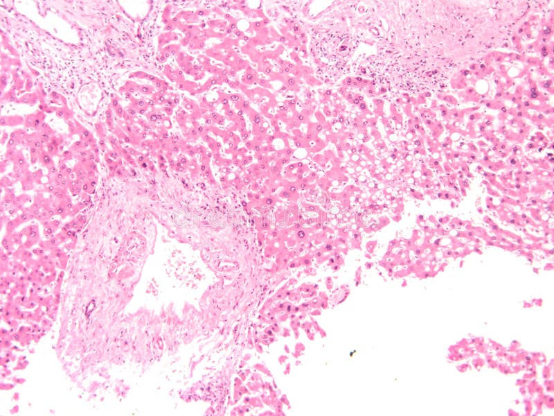 Histology of Human Liver Tissue Stock Image - Image of show, health ...