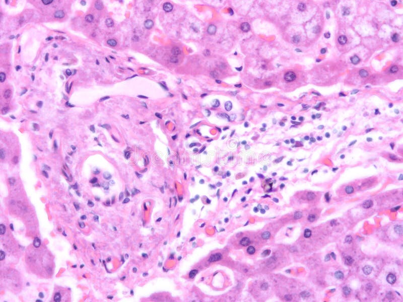 Histology of Human Liver Tissue Stock Photo - Image of medical, health ...
