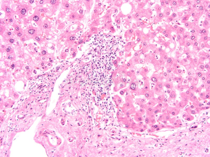 Histology of Human Liver Tissue Stock Photo - Image of larynx, muscle ...