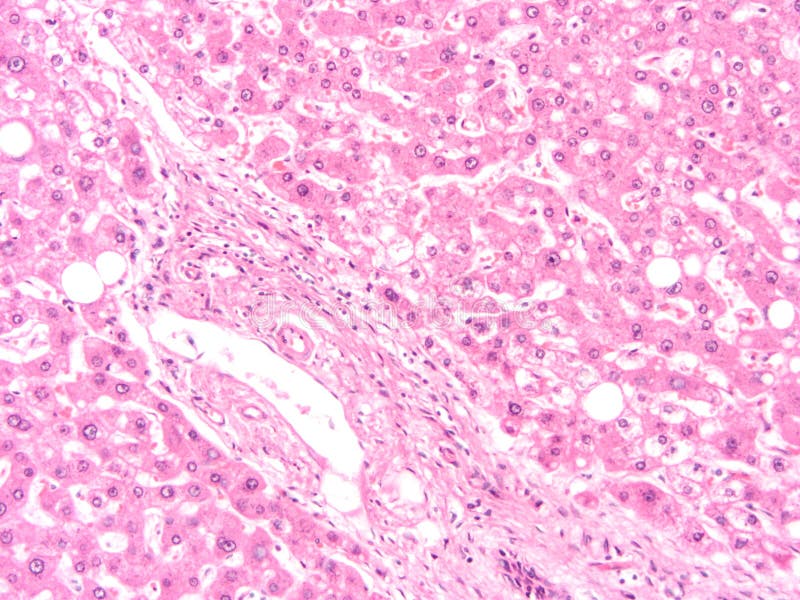 Histology of Human Liver Tissue Stock Image - Image of trachea, biology ...