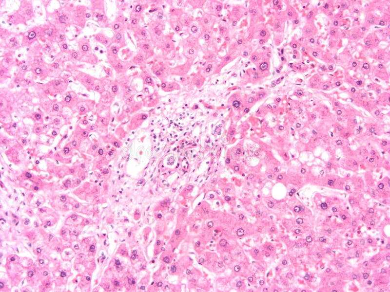 Histology of Human Liver Tissue Stock Image - Image of microscopy ...