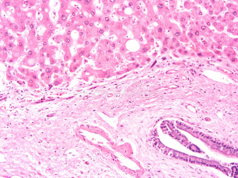 Histology of Human Liver Tissue Stock Photo - Image of human ...