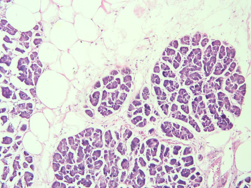 Histology of Human Pancreas Tissue Stock Image - Image of squamous ...