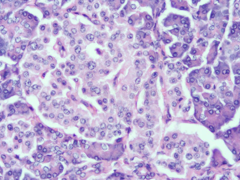 Histology of Human Pancreas Tissue Stock Image - Image of microscopic ...