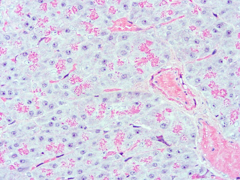 Histology of Human Pancreas Tissue Stock Photo - Image of kidney ...
