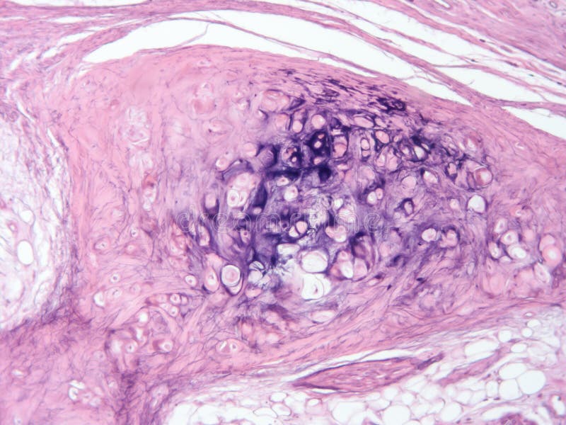 Histology of Cartilage Human Tissue Stock Image - Image of microscopy ...