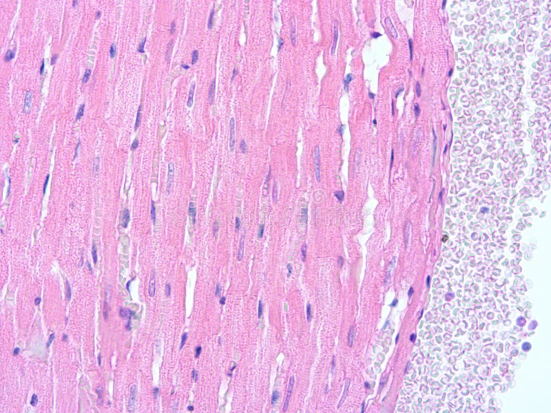 Histology of Heart Human Tissue Stock Photo - Image of cuboidal, muscle ...