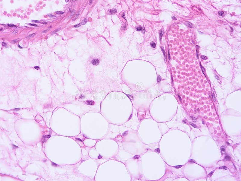 Histology of human tissue stock photo. Image of pathology - 100854584