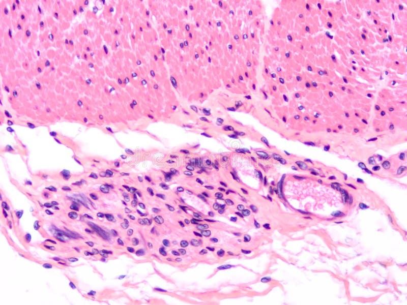 Histology of human tissue stock image. Image of research - 101564481