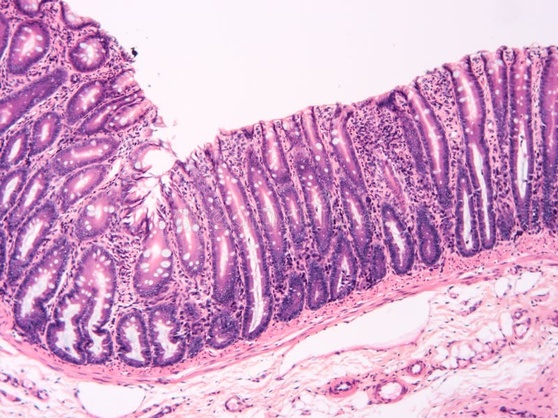 Histology of human tissue stock image. Image of human - 101573823