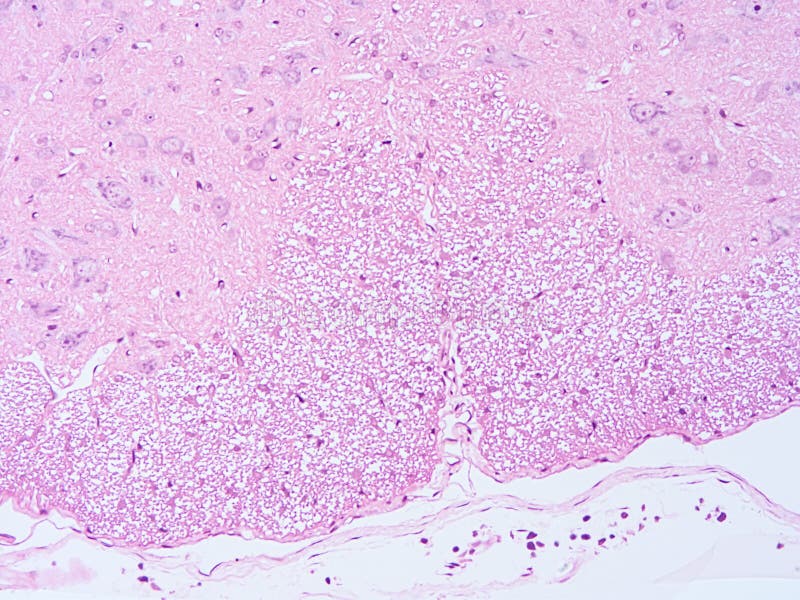 Histology of human tissue stock photo. Image of medical - 142924158