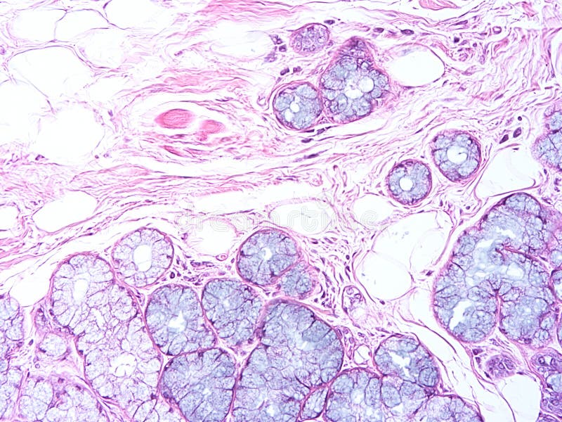 Histology of human tissue stock photo. Image of pathology - 143111746