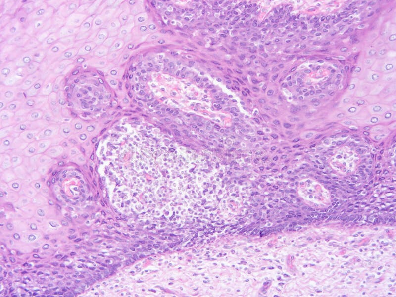 Histology of human tissue stock photo. Image of human - 143425660