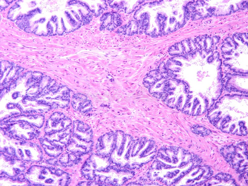 Human Heart Under The Microscope