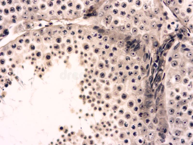 Histology of Human Muscle Tendon Connection Tissue Stock Photo - Image ...