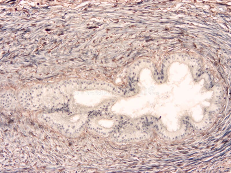 Histology of human tissue stock image. Image of histology - 144206161