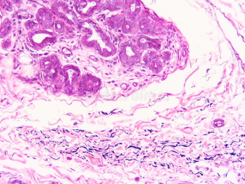 Histology of Epiglottis Human Tissue Stock Image - Image of study ...
