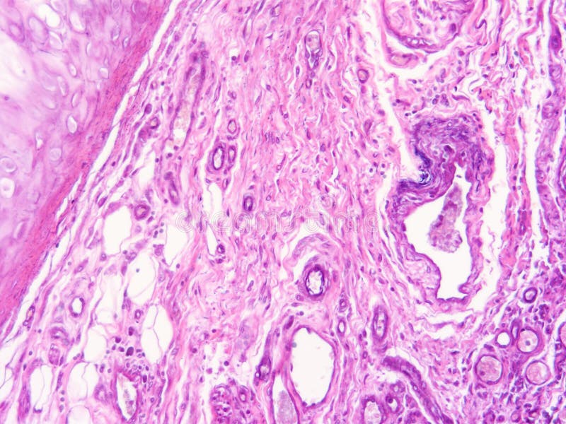 Histology of Epiglottis Human Tissue Stock Image - Image of view, gland ...