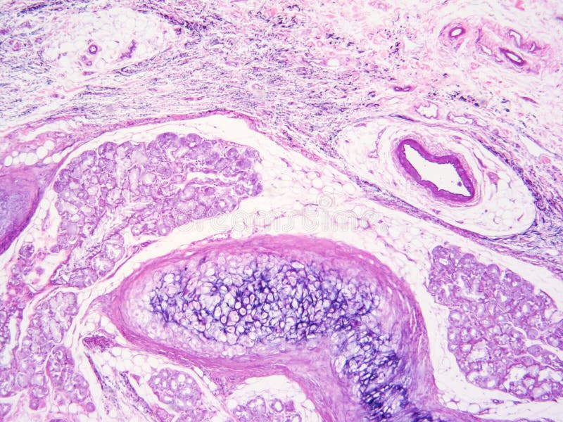 687 Epiglottal Stock Photos - Free & Royalty-Free Stock Photos from ...