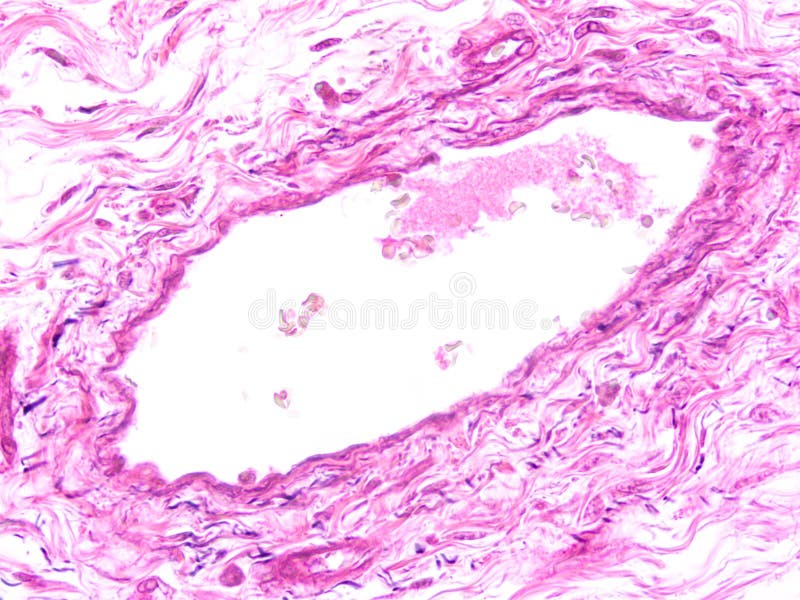 Histology of Epiglottis Human Tissue Stock Image - Image of show ...