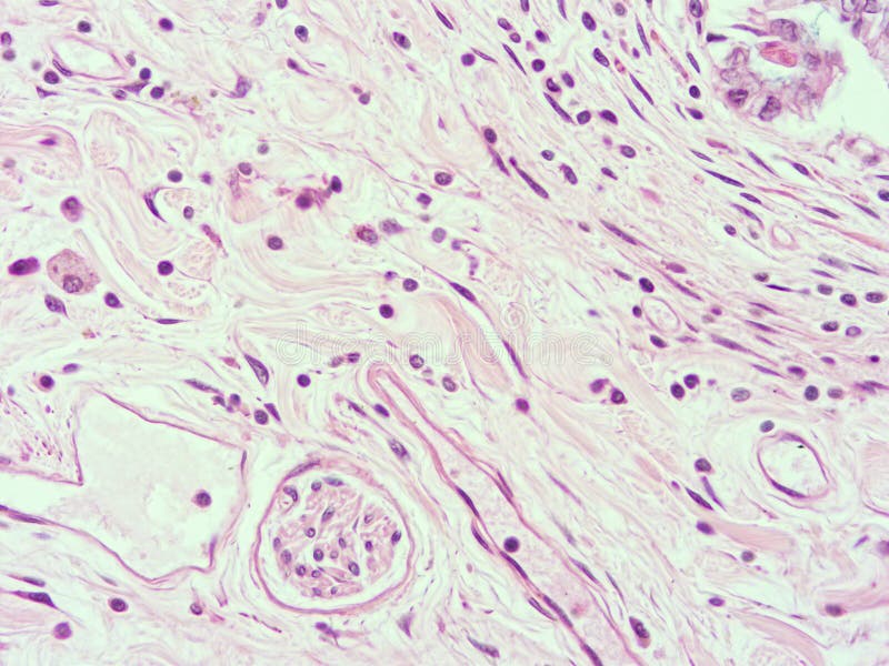 Histology of Human Gallbladder Tissue Stock Photo - Image of physiology ...