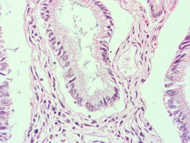 Histology of Human Gallbladder Tissue Stock Image - Image of ...