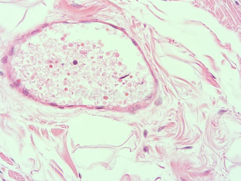 Histology of Human Gallbladder Tissue Stock Photo - Image of pathology ...