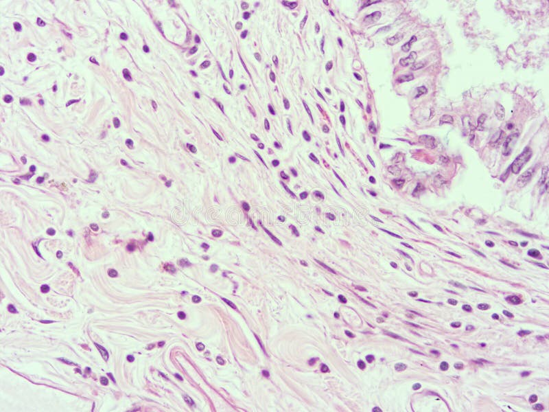 Histology of Human Gallbladder Tissue Stock Photo - Image of connective ...