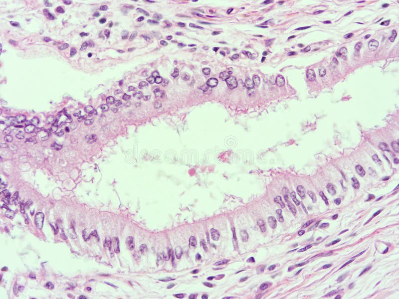 Histology of Human Gallbladder Tissue Stock Image - Image of epithelium ...