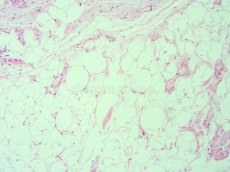 Histology of Human Gallbladder Tissue Stock Image - Image of health ...