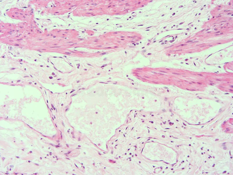 Histology of Human Gallbladder Tissue Stock Photo - Image of epiglottis ...