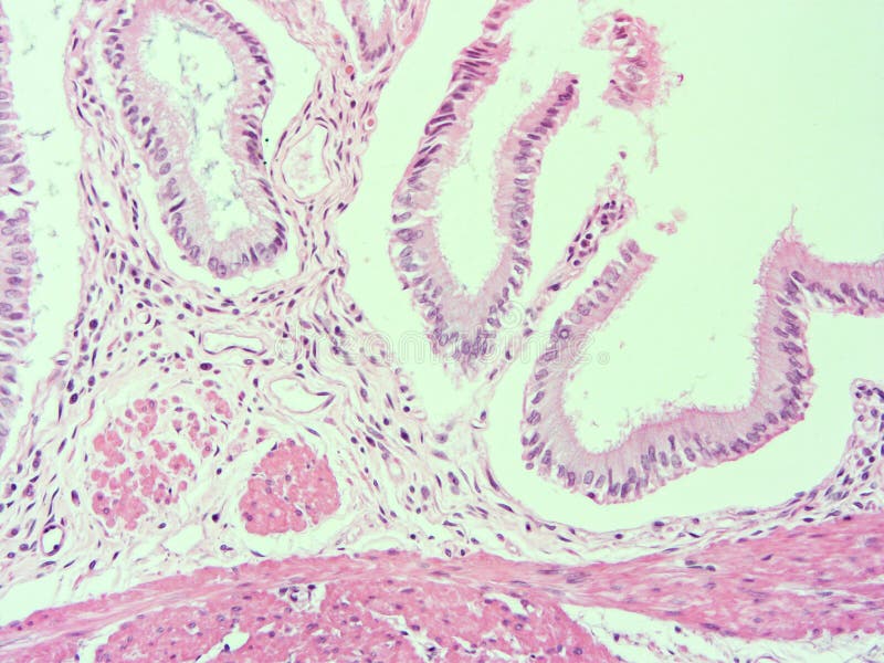Histology of Human Gallbladder Tissue Stock Image - Image of columnar ...