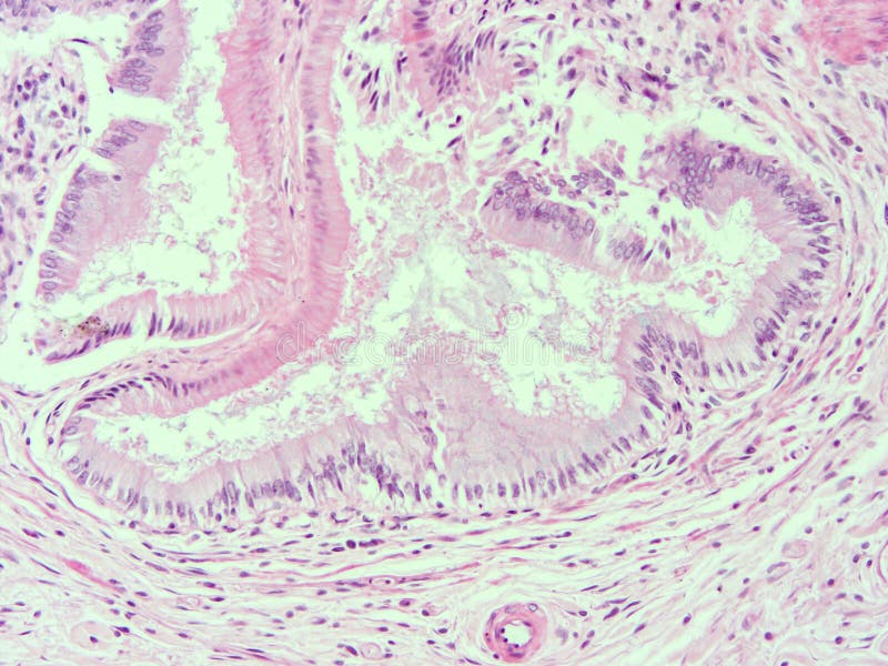 Histology of Human Gallbladder Tissue Stock Photo - Image of pathology ...