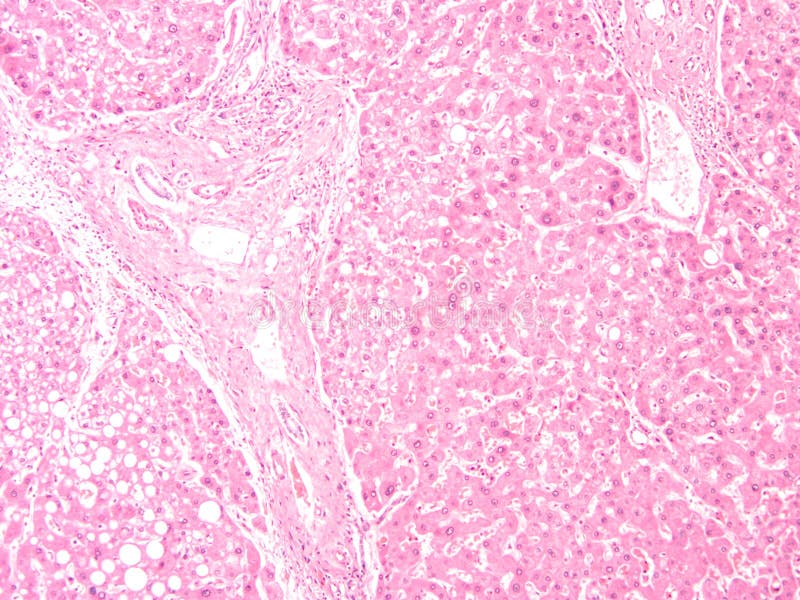 Histology of Human Liver Tissue Stock Image - Image of science ...