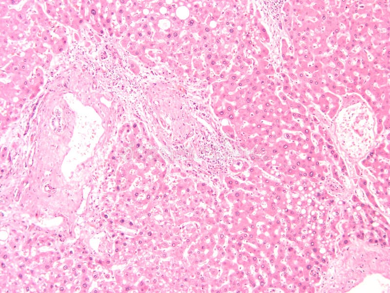 Histology of Human Liver Tissue Stock Image - Image of science ...