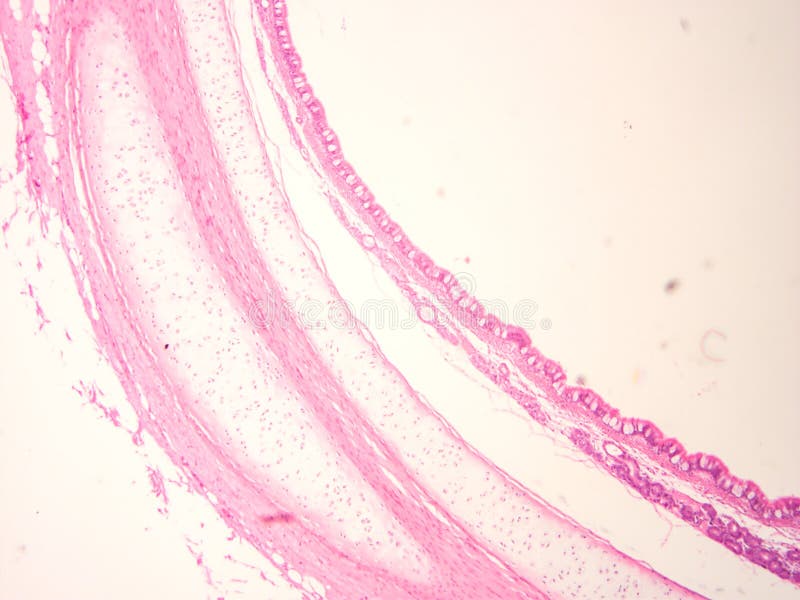 Histology of Trachea Human Tissue Stock Image - Image of study, biology ...