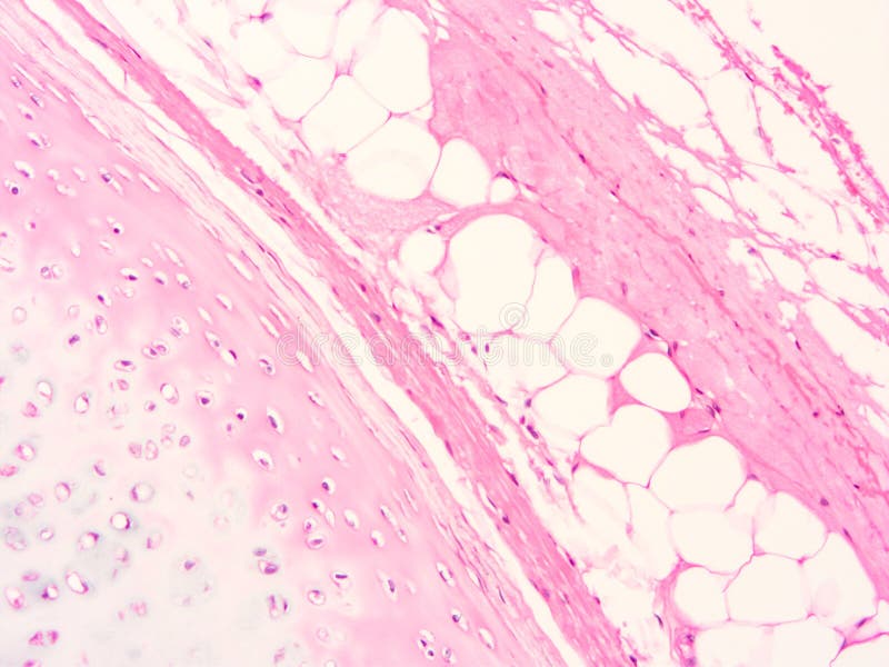 Histology of Trachea Human Tissue Stock Image - Image of cuboidal ...