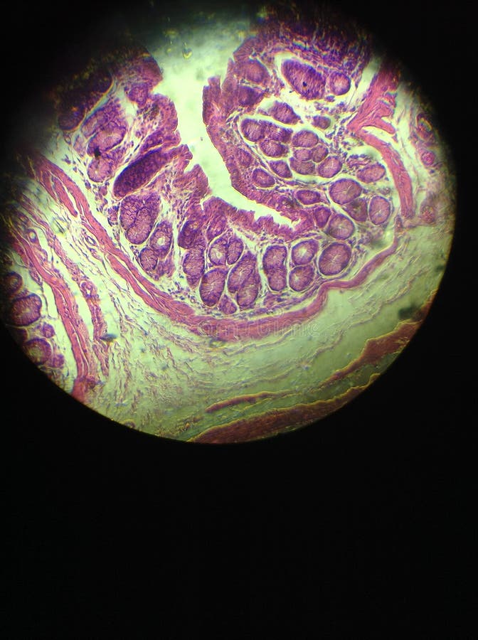 Histology of the Colon stock image. Image of laboratory - 42768595