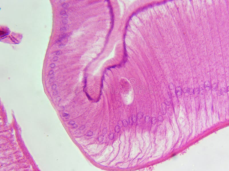 Histology Microscope Image of Female Ascaris Roundworm Intestines Cross ...