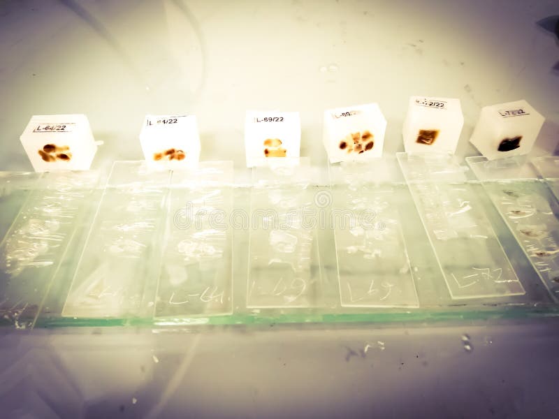 Histology Paraffin Embedded Tissue Samples into a Slide Stock Photo ...