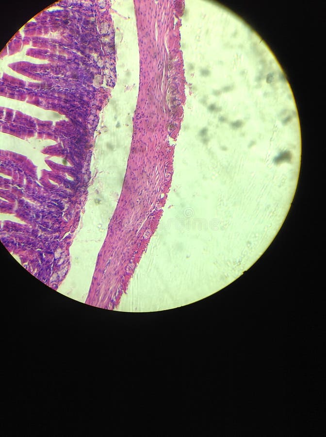 Histology Of Jejunum, Micrograph Stock Image - Image of eosin ...