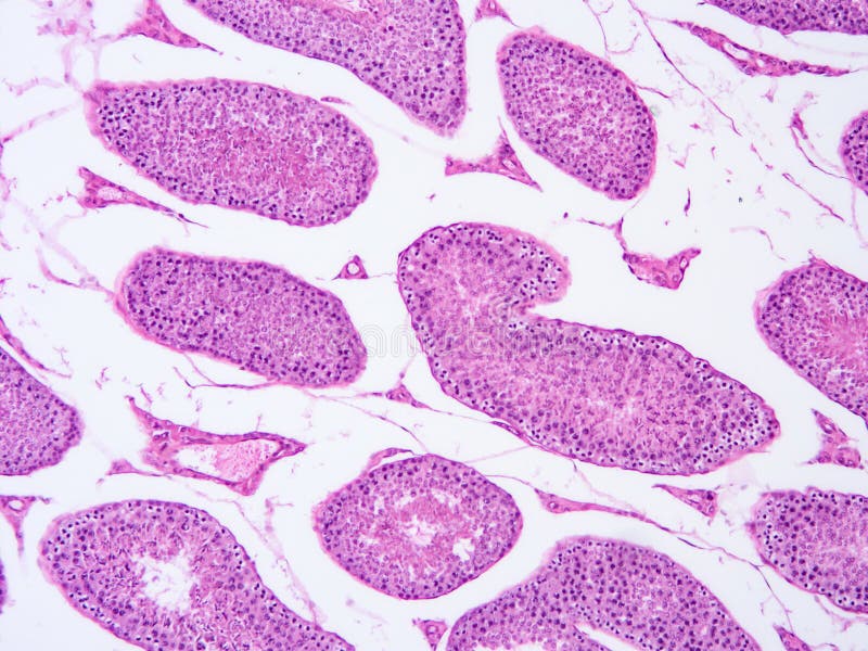Histology of Testis Human Tissue Stock Image - Image of pathology ...