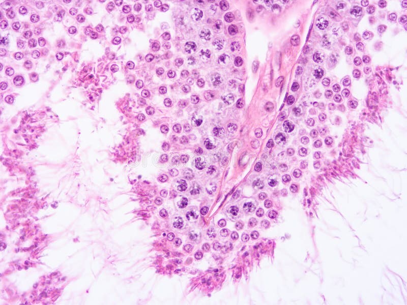 Histology of Testis Human Tissue Stock Image - Image of medical ...