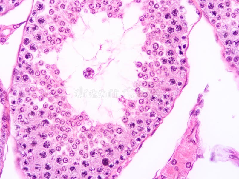 Histology of Testis Human Tissue Stock Photo - Image of human, cuboidal ...
