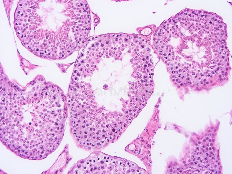 Histology of Testis Human Tissue Stock Photo - Image of pathology ...