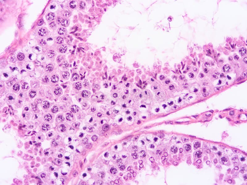 Histology of Testis Human Tissue Stock Image - Image of cell, human ...